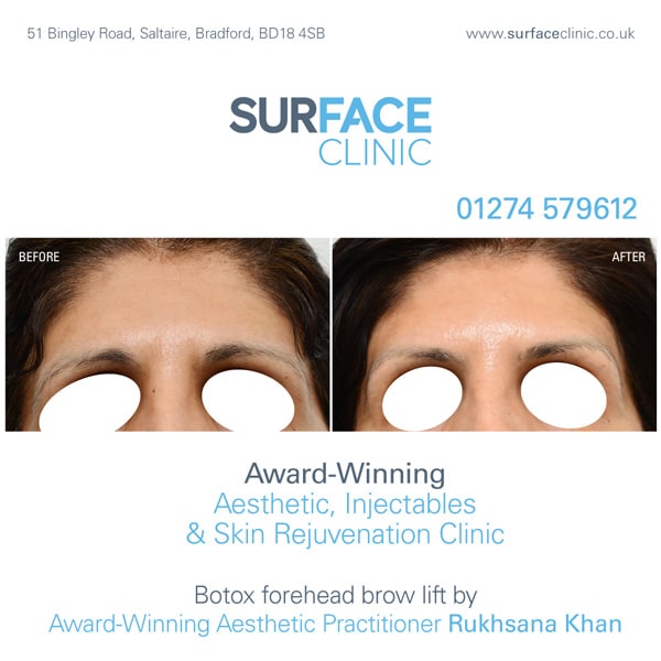 Botox - Surface Clinic