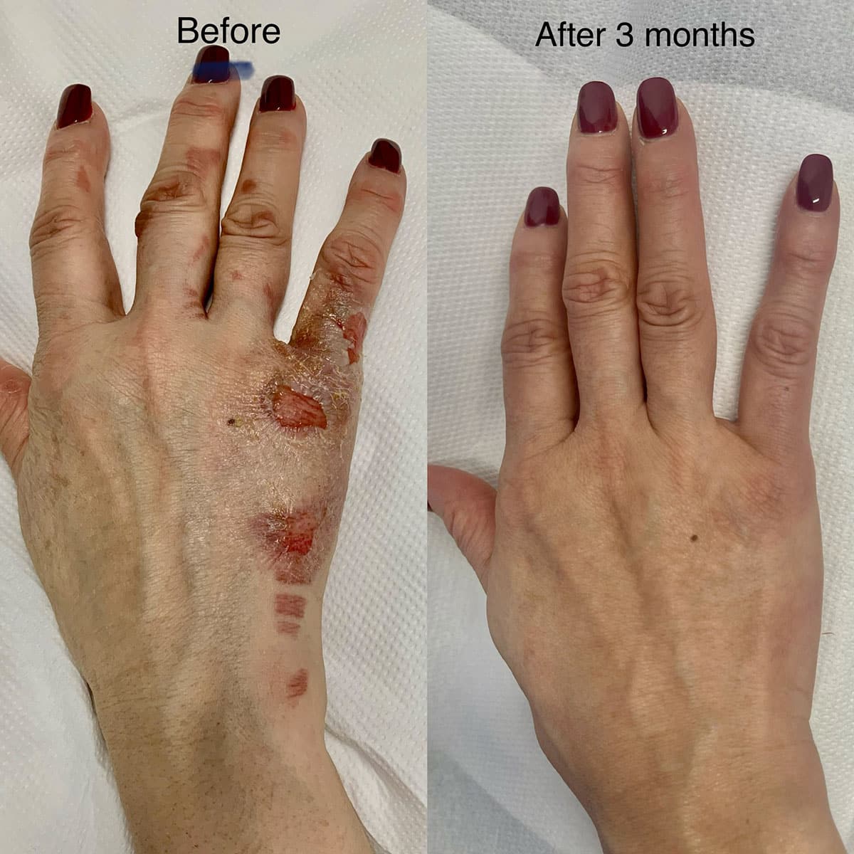 Hands - Surface Clinic
